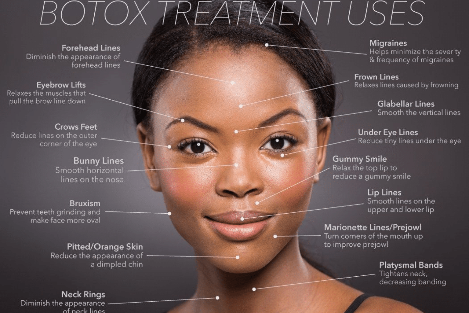 Where Can You Get Botox? Exploring Treatment Areas and Their Benefits ...
